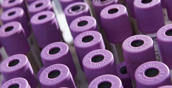 New BVD ear punch PCR test available | The Cow Vets (2000) Ltd