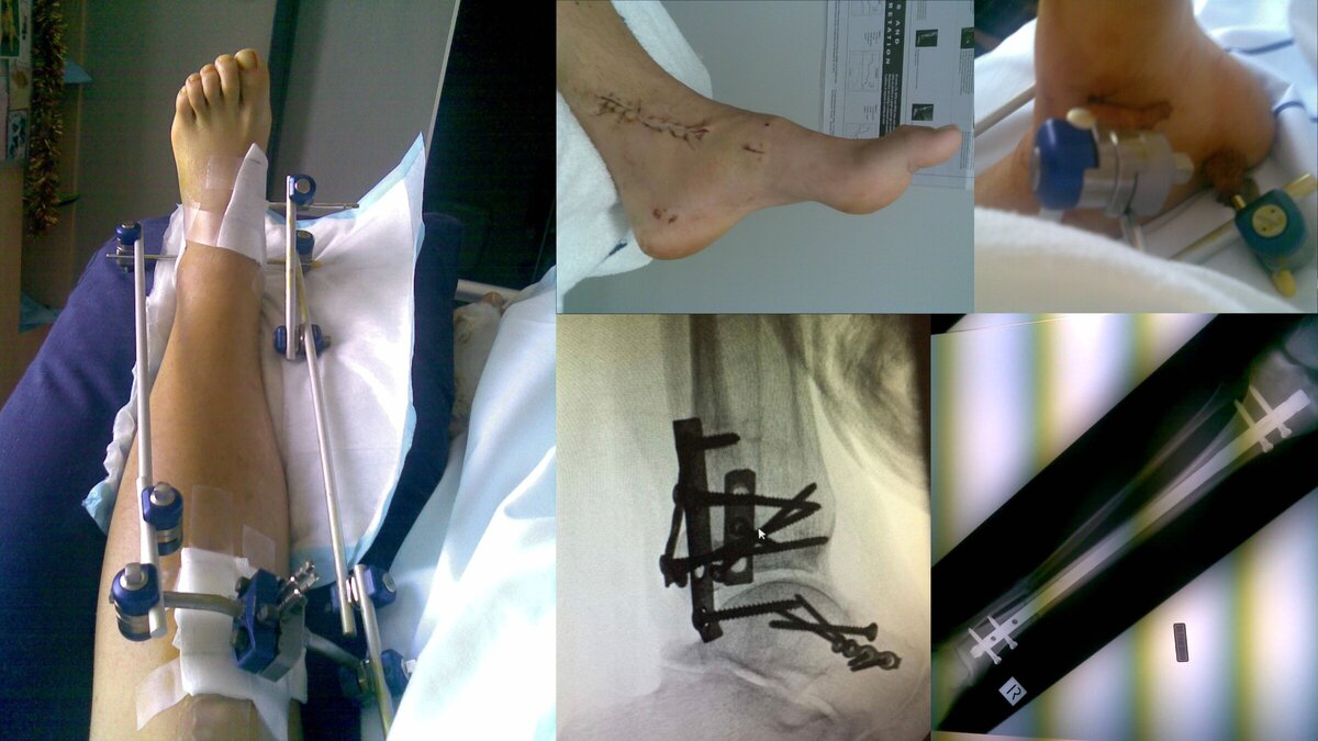 Youth Encounter | Unleashed Potential: Mary shares some of the ...