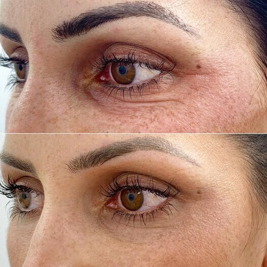 Plasmage | Cosmetic Clinic | Truyou Appearance Medicine