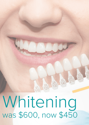 Special Offers | Cambridge Dental Clinic