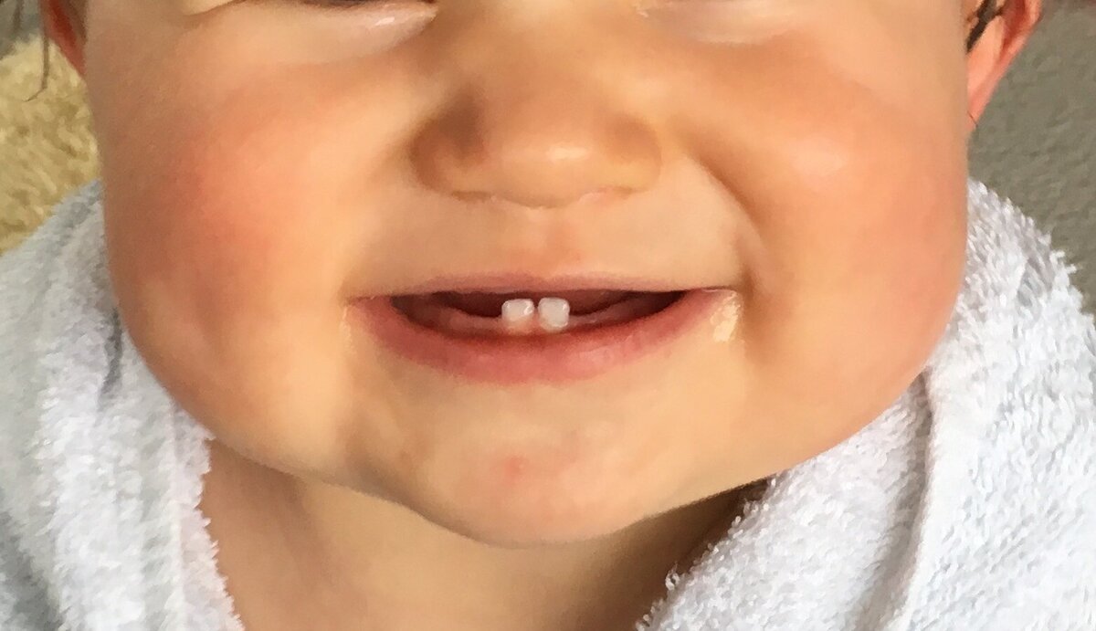 Teething, what to look out for | The Dental Hygienist
