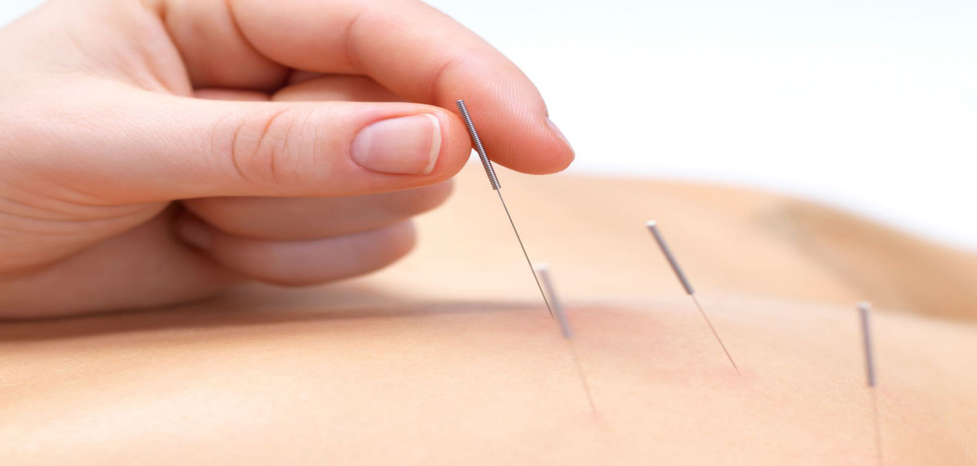 Auckland Health and Beauty | Acupuncture | Health Acu Ltd