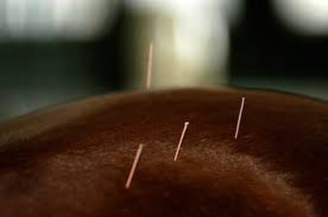 Animal-MRT | Equine Poll and Neck Problems