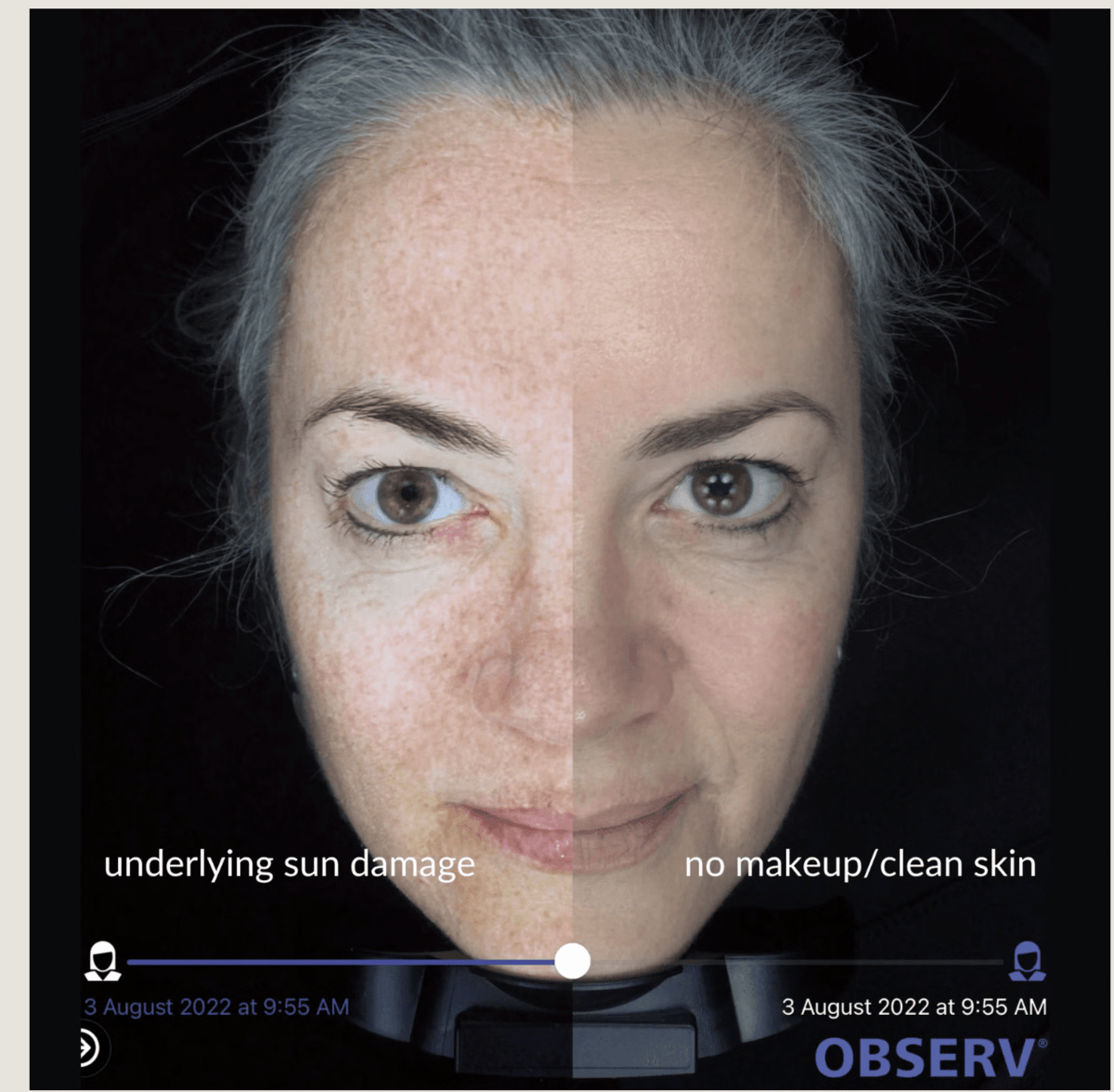 Observ Skin Analysis - starting point of every skin journey. | Pure ...
